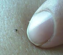 Colorado Tick-Borne Disease Awareness Association (COTBDAA) - Education ...